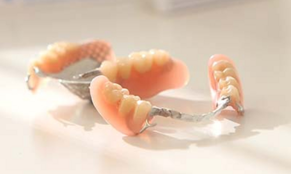 Behandlinger | Klinisk Tandtekniker Lars Kongsbak